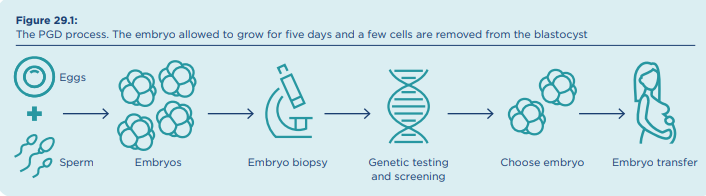 Pre Implantation Process