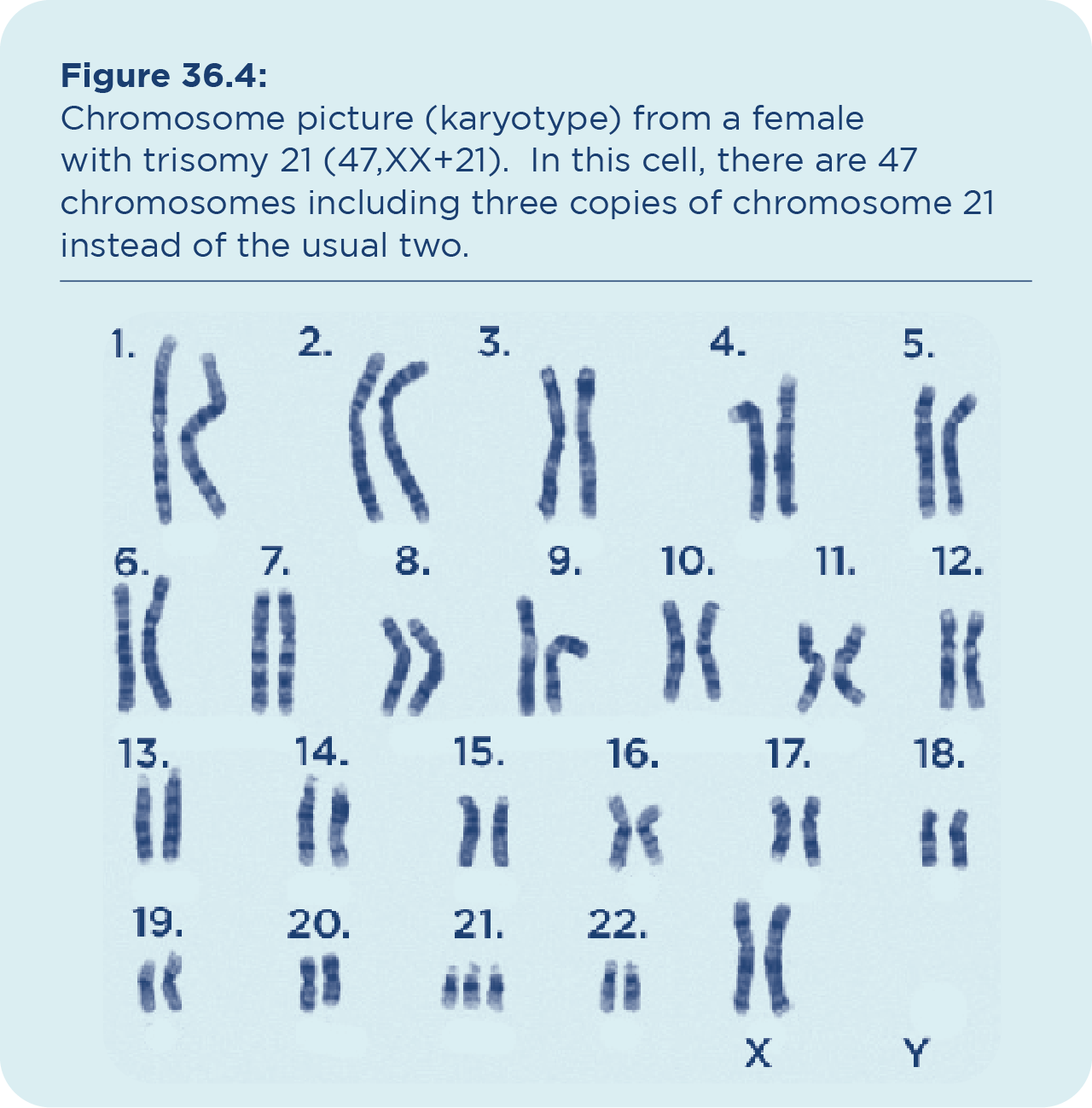Chromosome 21 Chromosome 21 An Overview | ScienceDirect Topics