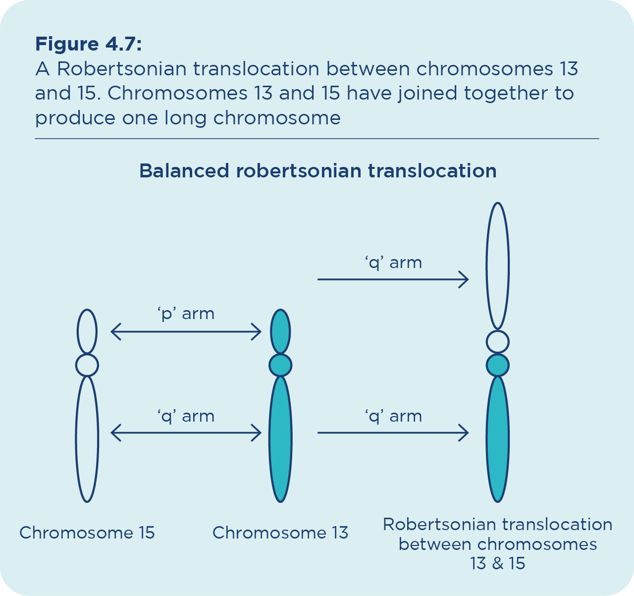 Robertsonian Translocation Balanced Vs Unbalanced