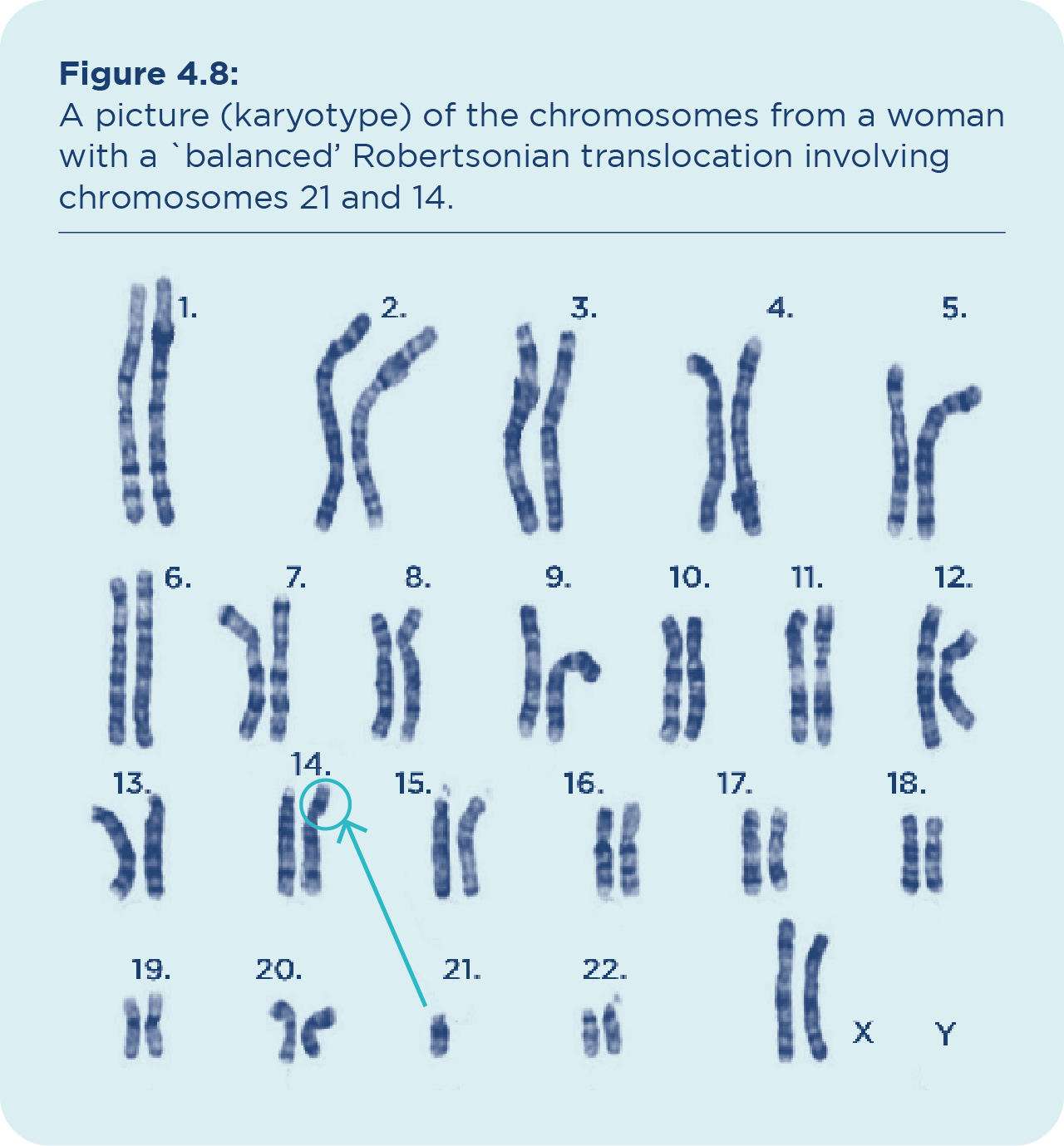 Translocation Mutation Genetic Mutation | Learn Science At Scitable
